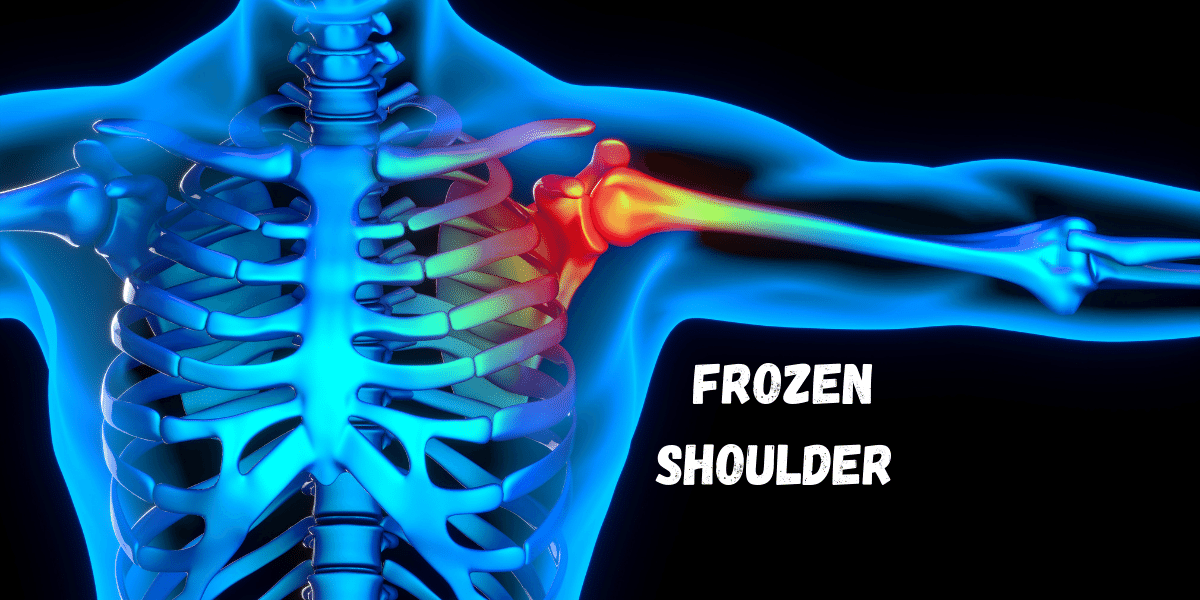 Frozen Shoulder | Pivotal Osteopathy - Ringwood